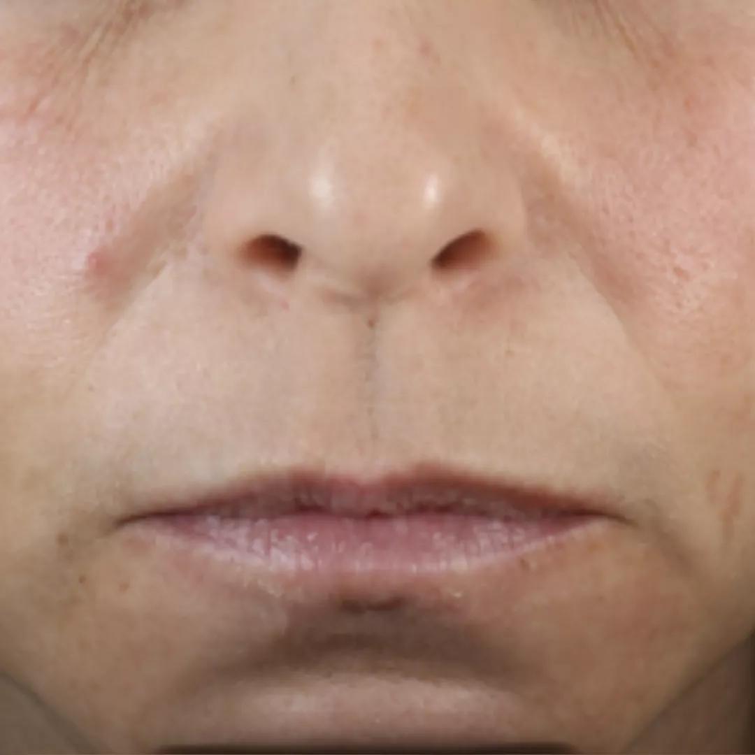 Melaclear Advanced | ISDIN