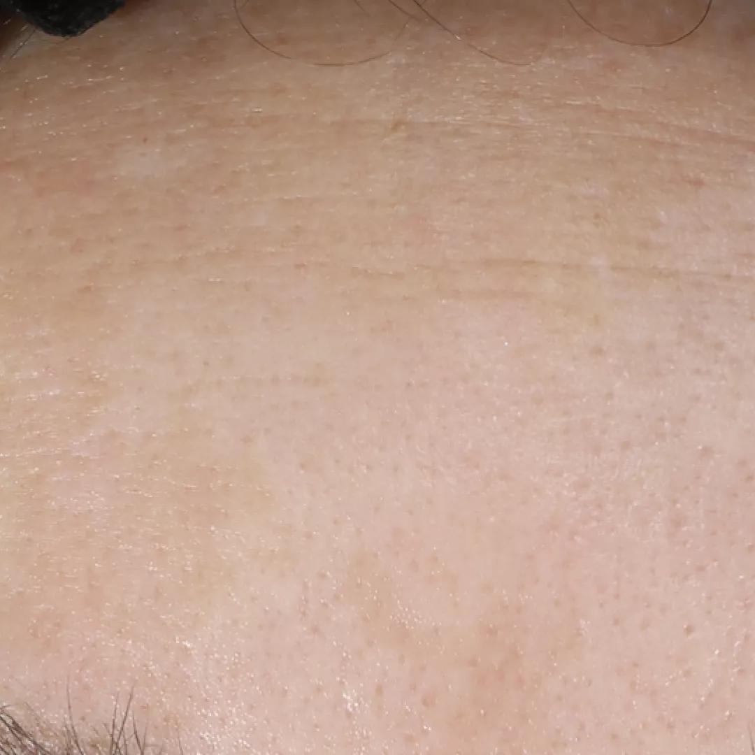 Retinal Intense | ISDIN